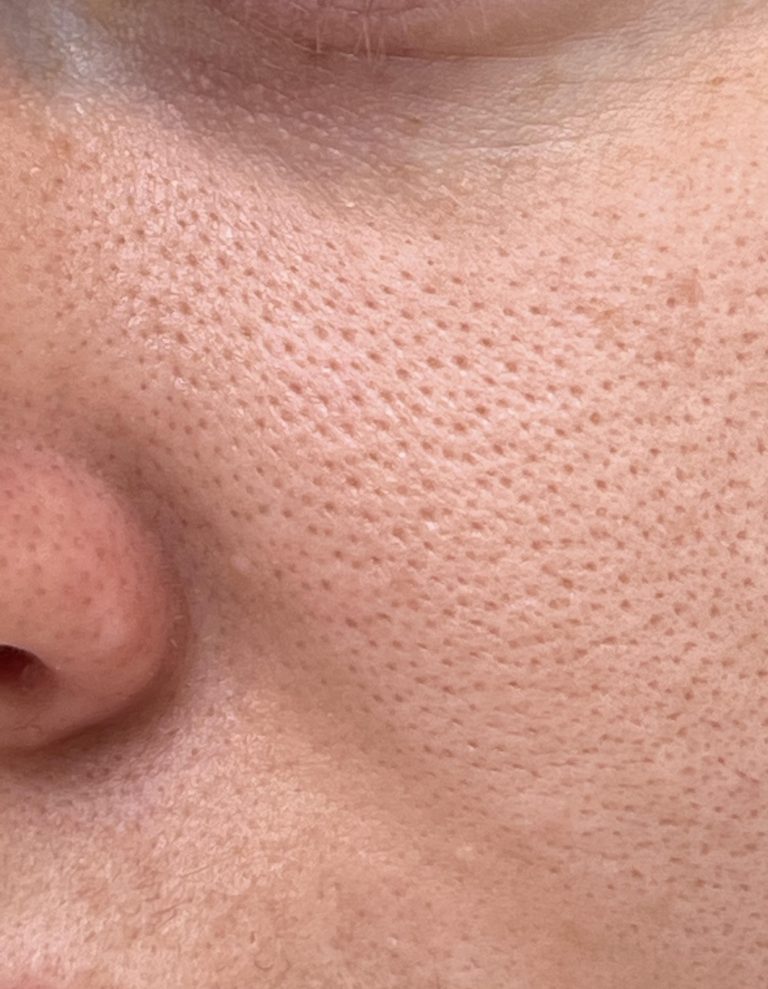 How to Shrink and Minimize Pores - ubm-japan.com